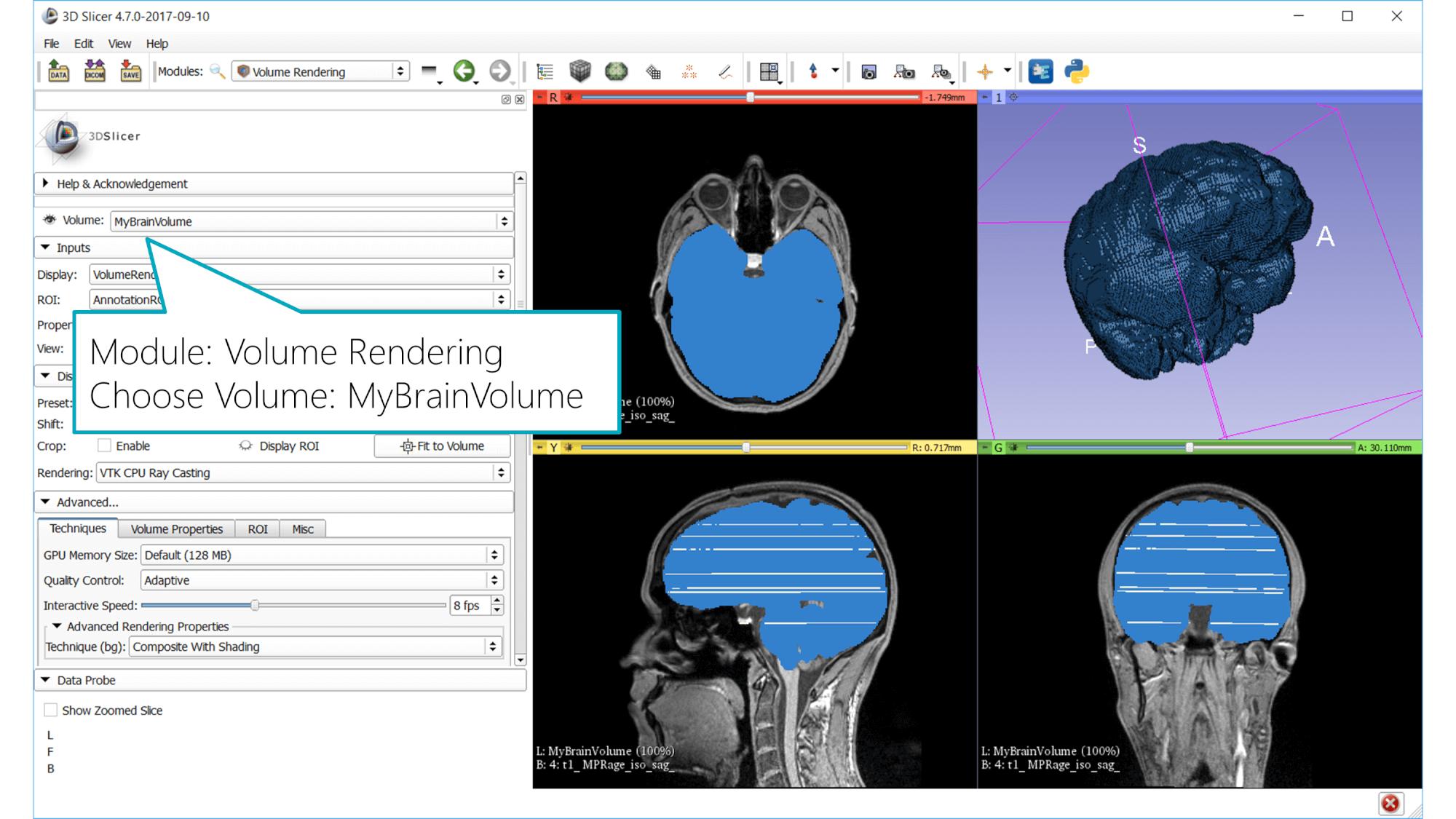 Visualizing Mri Ct Scans In Mixed Reality Vr Ar Part 4